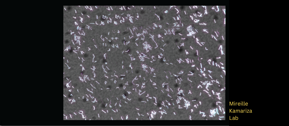 Immunity, Microbes, and Molecular Pathogenesis – Molecular Biology ...