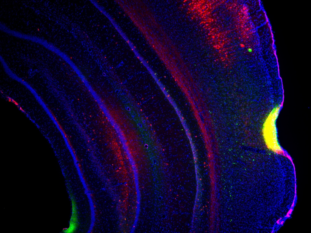 Welcome to the Fanselow Lab – Information related to Dr. Michael S ...